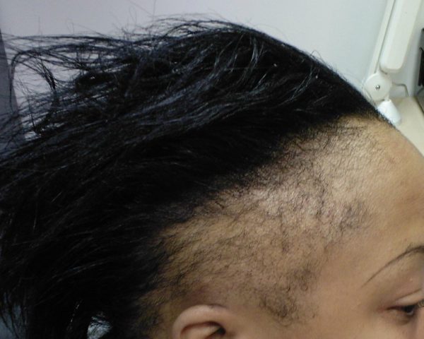 Top 10 Reasons Your Edges Are Thinning And Breaking ⋆ Chimere Nicole